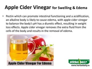 Foods to Eat in Swelling & Edema | PPT