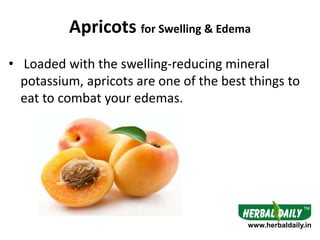 Foods to Eat in Swelling & Edema | PPTX