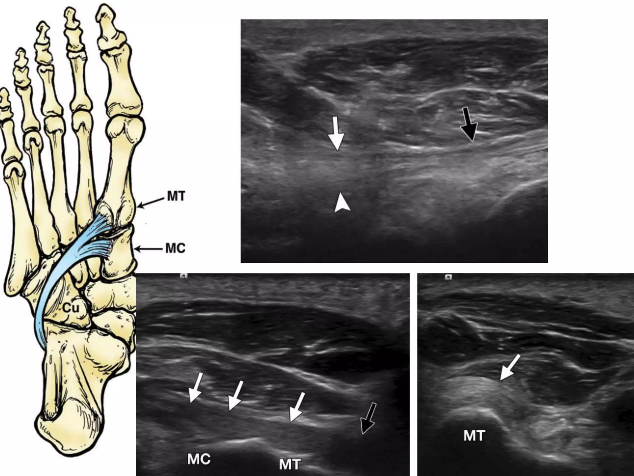 Musculoskeletal Ultrasound examination of the Foot | PPTX