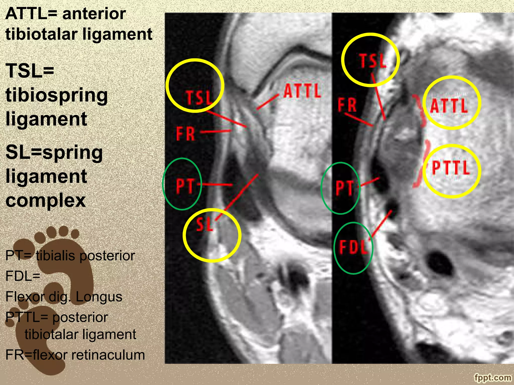 Foot radiological anatomy. shorouk zaki | PDF