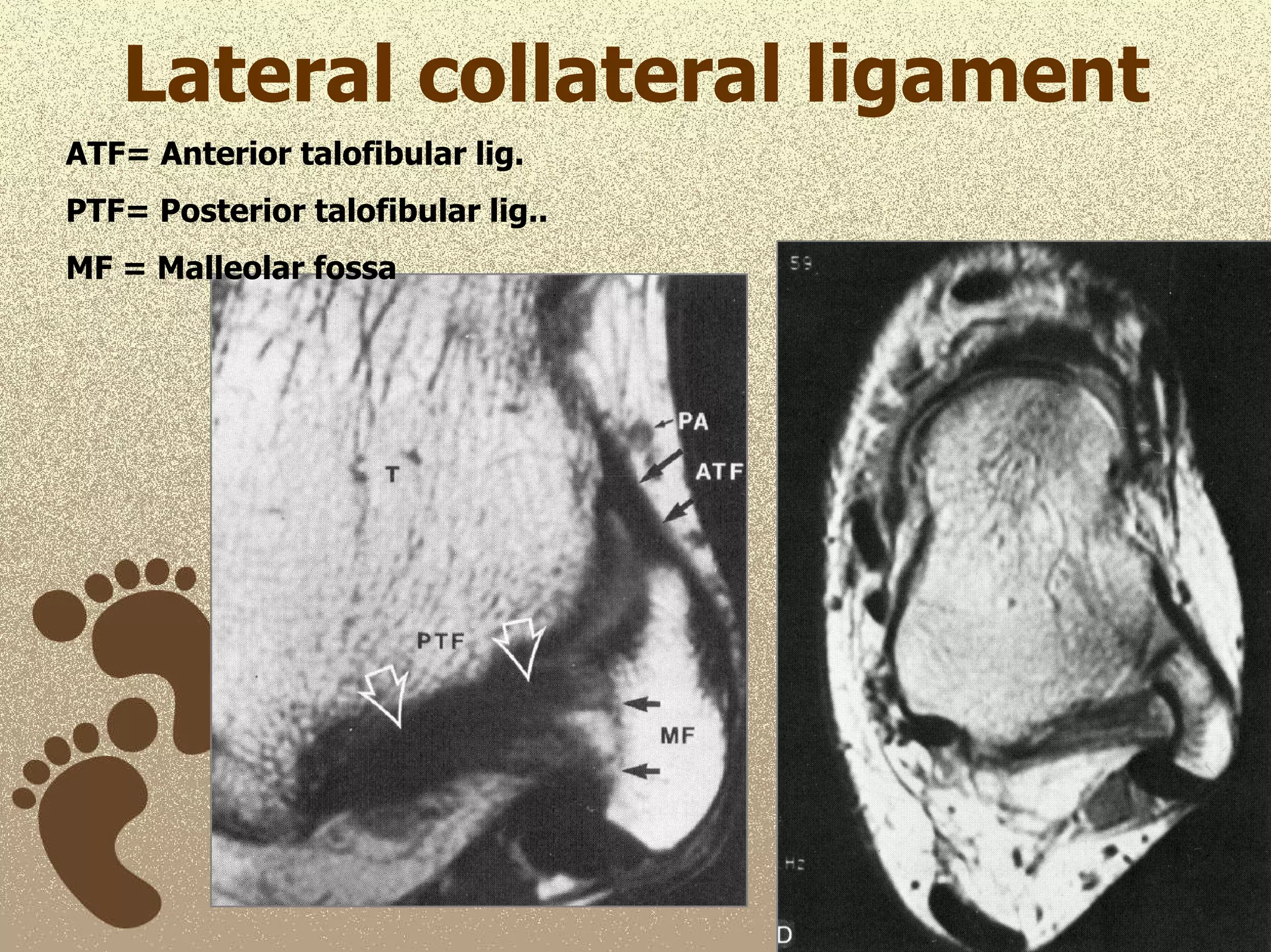 Foot radiological anatomy. shorouk zaki | PDF