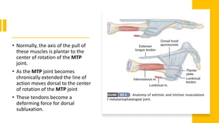 LESSER TOE ABNORMALITIES | PPTX