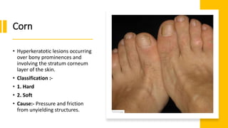 LESSER TOE ABNORMALITIES | PPTX | Death, Injury, or Military Conflict | Sensitive Topics