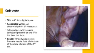 LESSER TOE ABNORMALITIES | PPTX | Death, Injury, or Military Conflict | Sensitive Topics