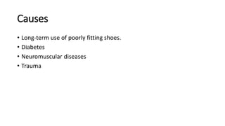 LESSER TOE ABNORMALITIES | PPTX | Death, Injury, or Military Conflict | Sensitive Topics