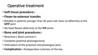 LESSER TOE ABNORMALITIES | PPTX