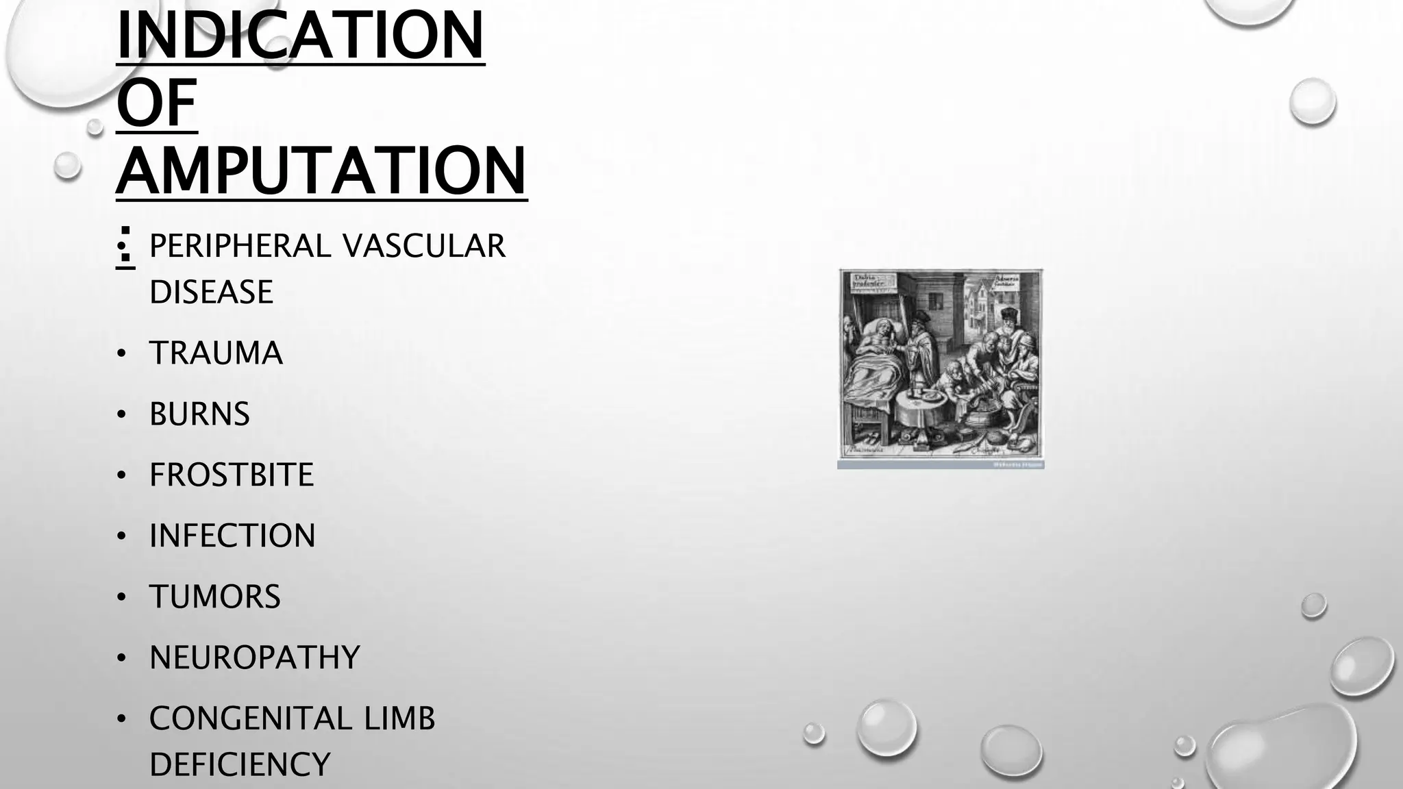 Amputations of foot and it's rehabilitation.pptx
