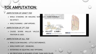 Amputations of foot and it's rehabilitation.pptx | Death, Injury, or ...