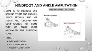 Amputations of foot and it's rehabilitation.pptx