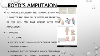 Amputations of foot and it's rehabilitation.pptx | Death, Injury, or ...