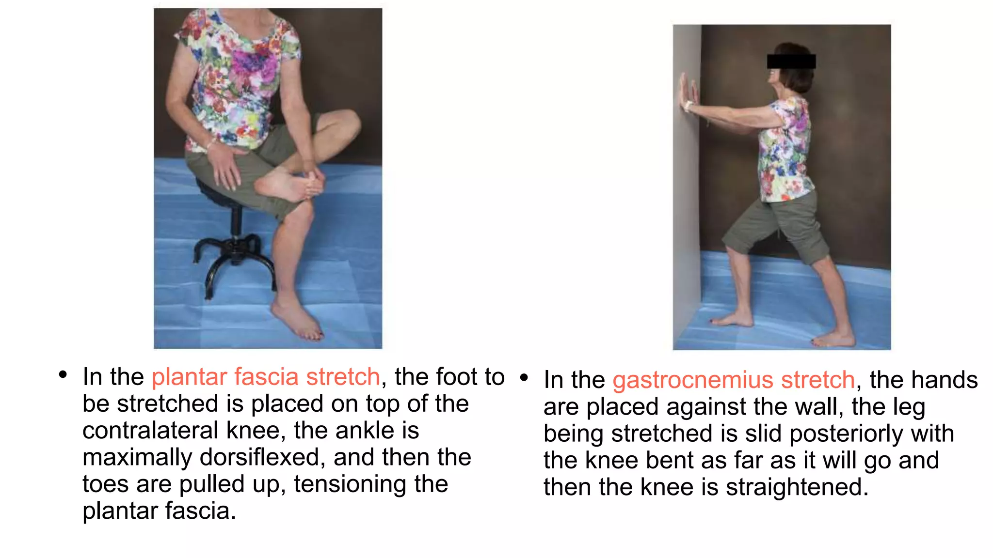 Arches of the foot and plantar fascitiis | PPTX