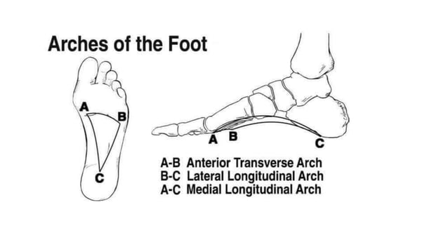 Arches of the foot and plantar fascitiis | PPTX