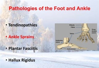 foot and ankle 2022- part II physiotherapy.pptx