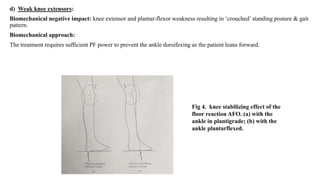 Biomechanics of Foot and Ankle complex, CP orthotic management &Tone ...