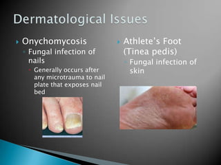 Common Foot and Ankle Injuries: You Don’t Have to Suffer! | PPTX