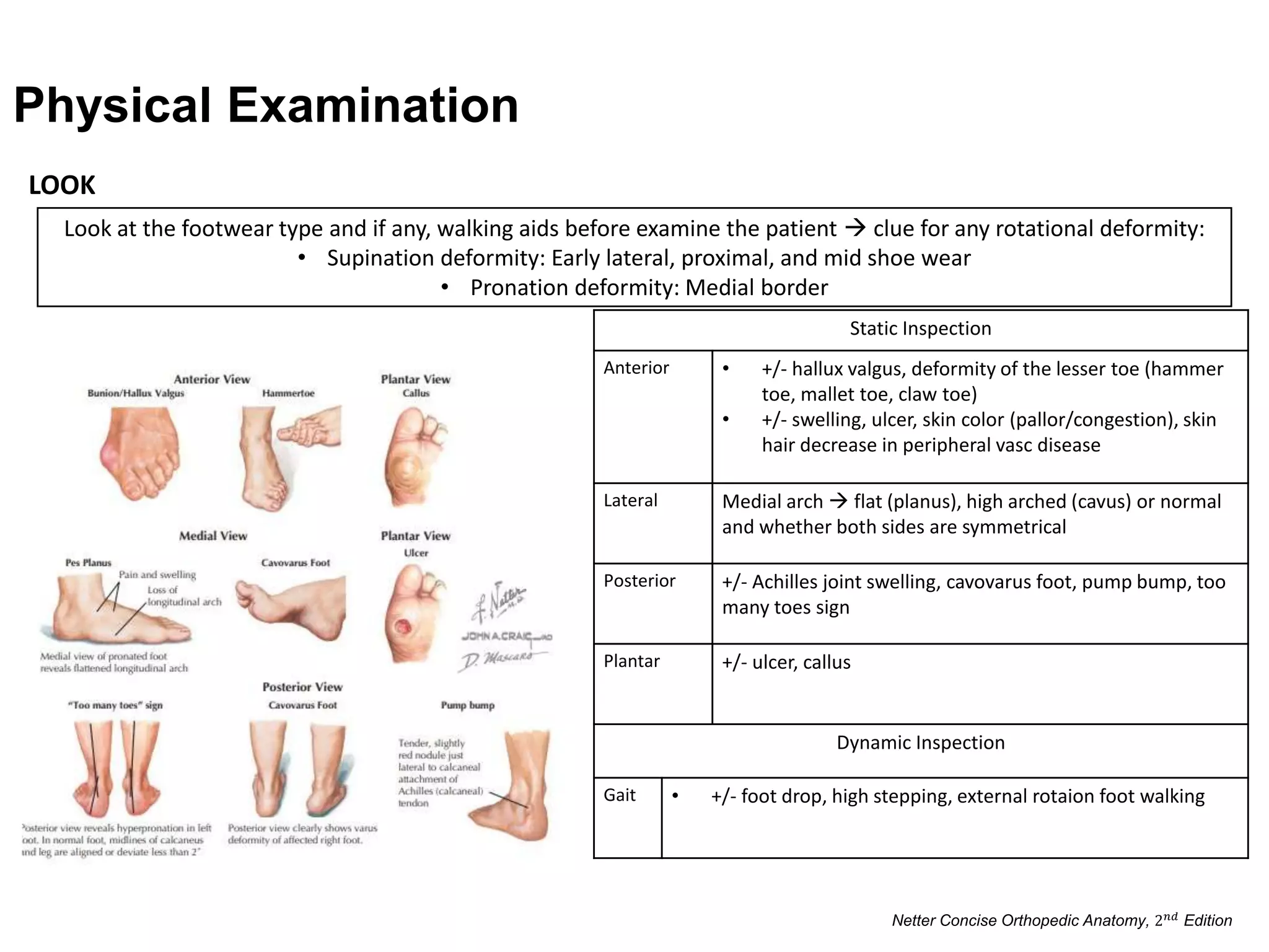 Foot and ankle instability | PPT