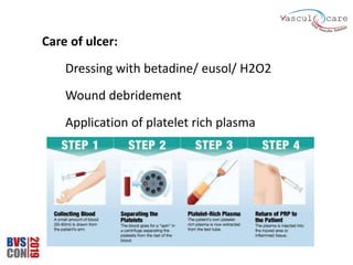 FOOT CARE AND ULCER MANAGEMENT AT VASCULOCARE: OUR AIM TO SALVAGE FOOT ...