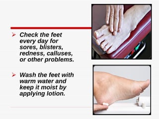 Foot Care 8 | PPT