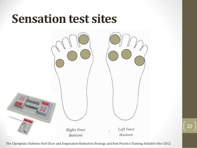 Champlain Diabetes Foot Ulcer and Amputation Reduction Strategy and B…