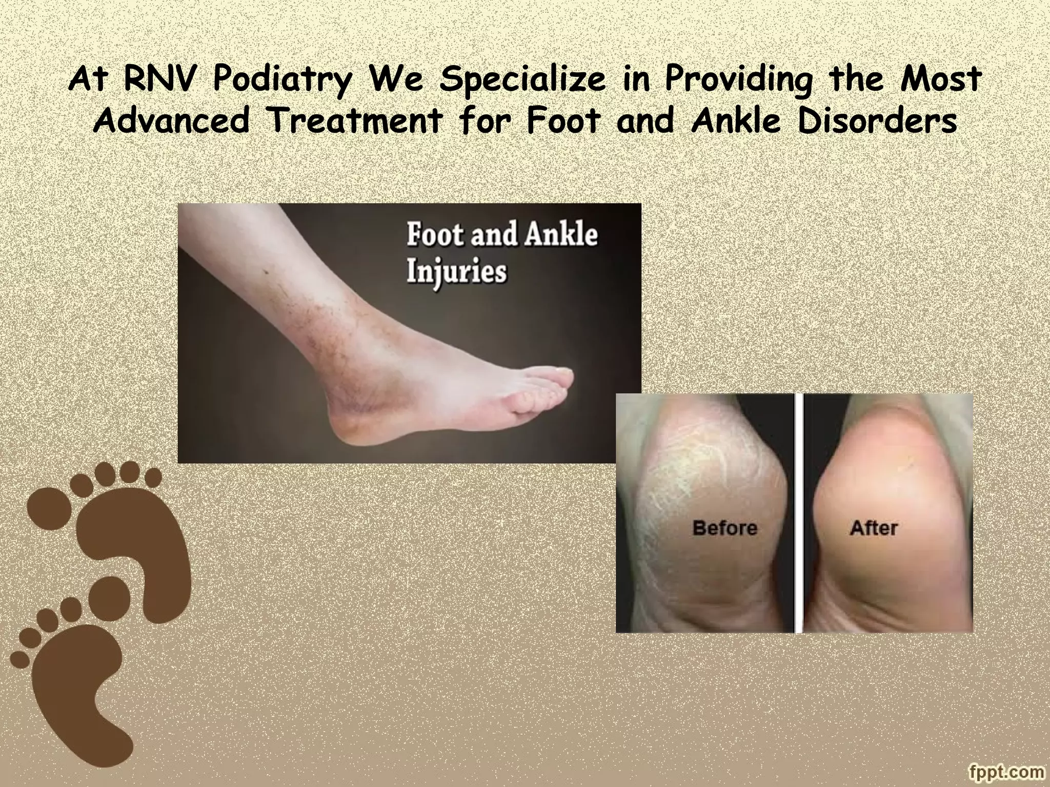 Foot corns, calluses & blister treatment | PPT