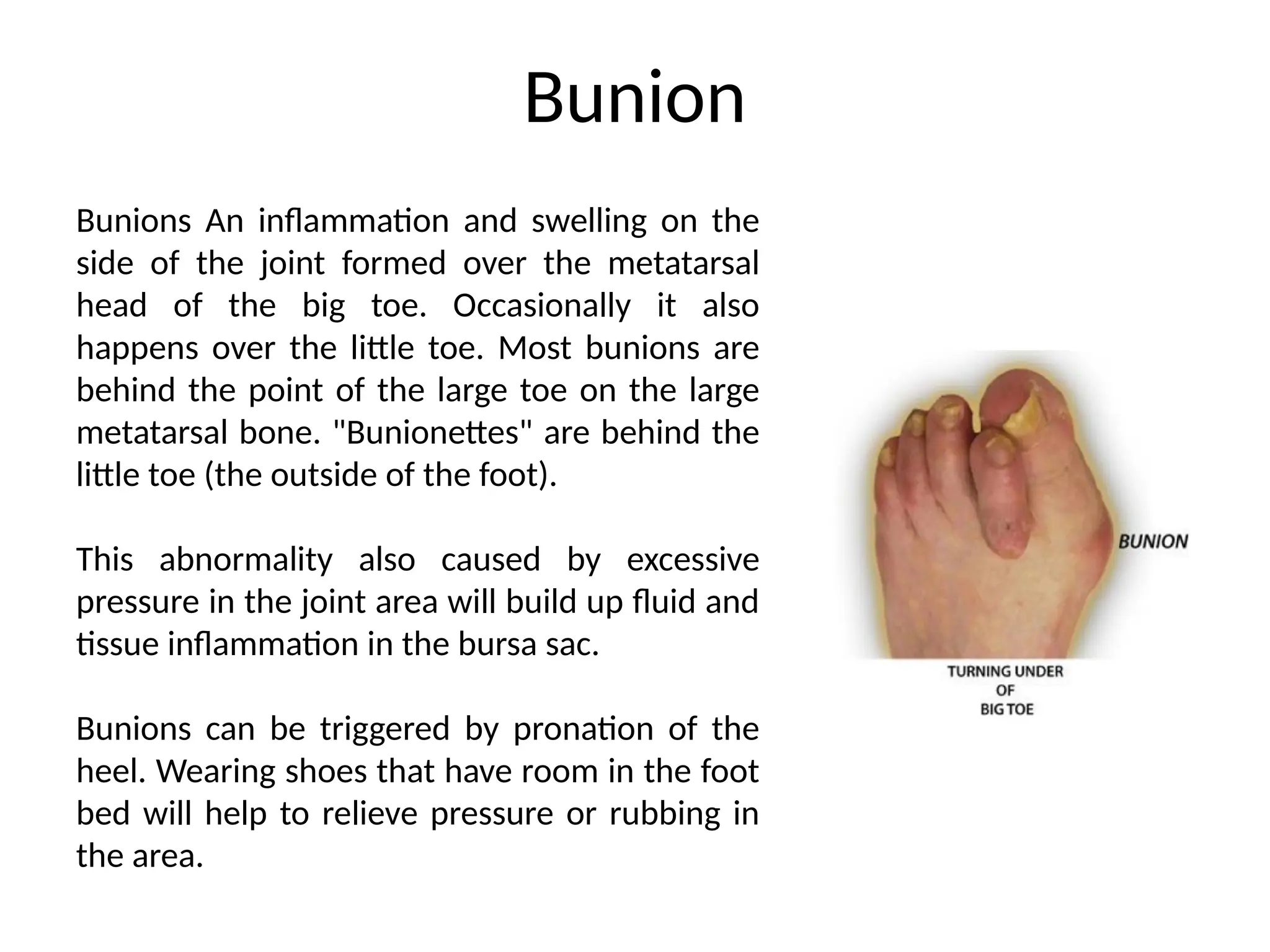 Types of Foot Deformities among human being | PPTX