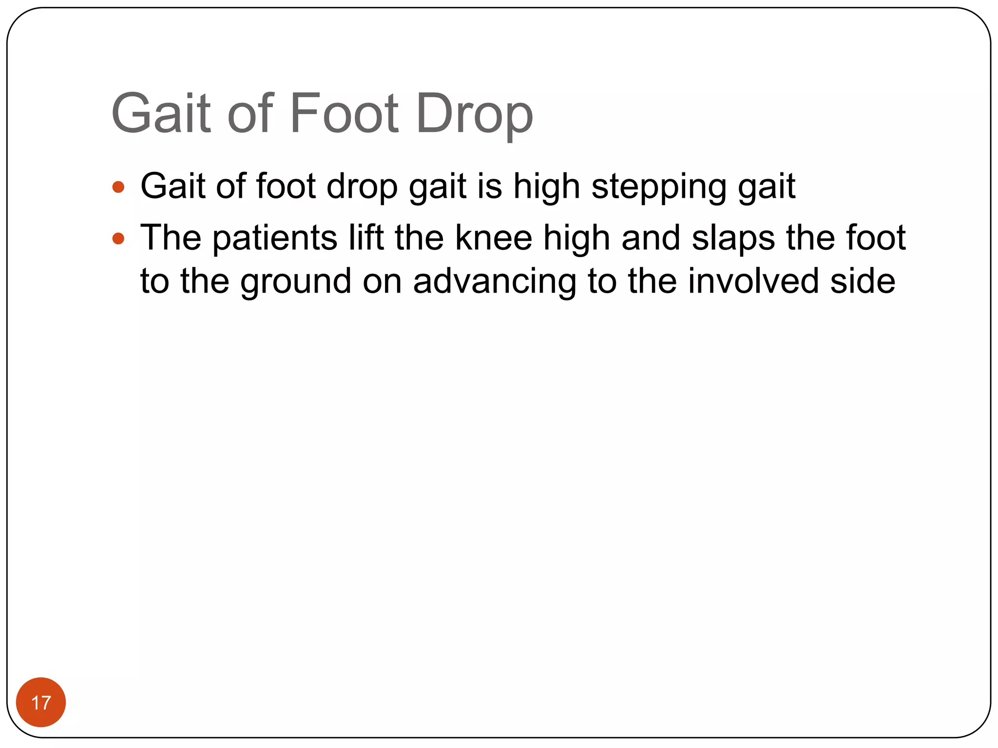 Foot drop | PPTX