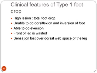 Foot drop | PPTX