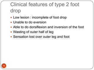 Foot drop | PPTX