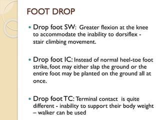 Foot drop | PPTX