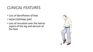 Foot drop | PPTX