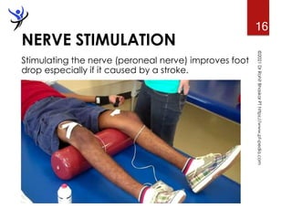 Foot Drop: Causes, Symptoms, and Treatment - Dr Rohit Bhaskar | PDF