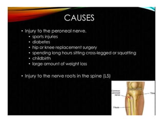 An approach to Foot drop | PPT