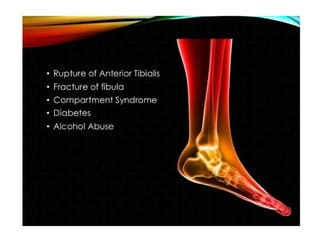 An approach to Foot drop | PPT