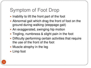 An approach to Foot drop | PPT