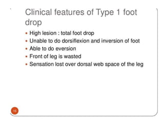 An approach to Foot drop | PPT