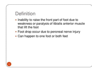 An approach to Foot drop | PPT