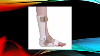 Foot drop presentation and orthosis role | PDF