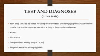 Foot drop philans cosmos ankrah | PPSX
