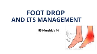 FOOT DROP AND ITS MANAGEMENT orthopedics | PPTX