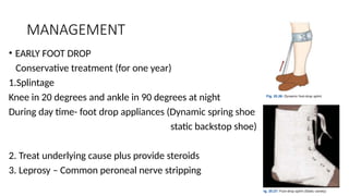 FOOT DROP AND ITS MANAGEMENT orthopedics | PPTX