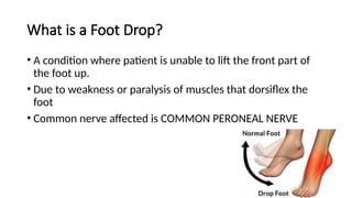 FOOT DROP AND ITS MANAGEMENT orthopedics | PPTX