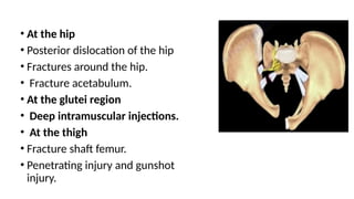 FOOT DROP AND ITS MANAGEMENT orthopedics | PPTX