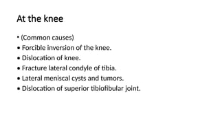 FOOT DROP AND ITS MANAGEMENT orthopedics | PPTX