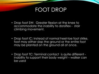 Foot Drop | PPTX