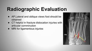 FOOT FRACTURE.pptx