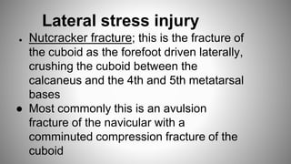 FOOT FRACTURE.pptx