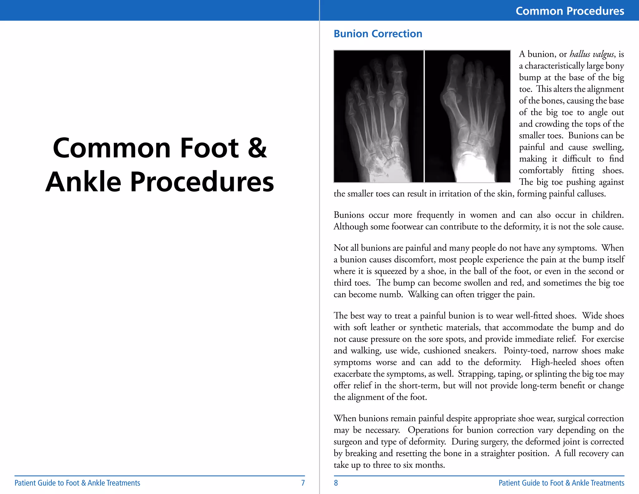 Footguide 09162013-noninteractive | PDF