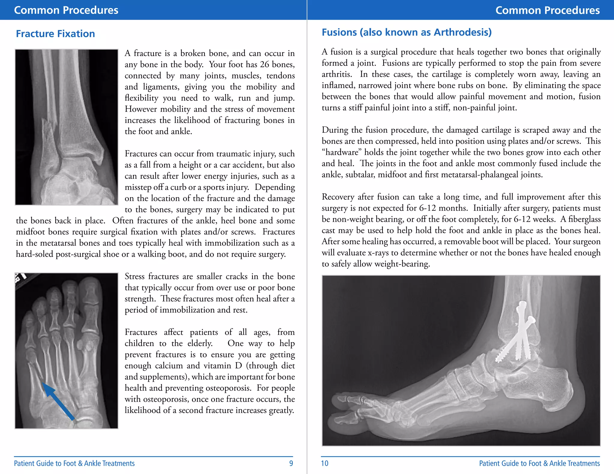 Footguide 09162013-noninteractive | PDF