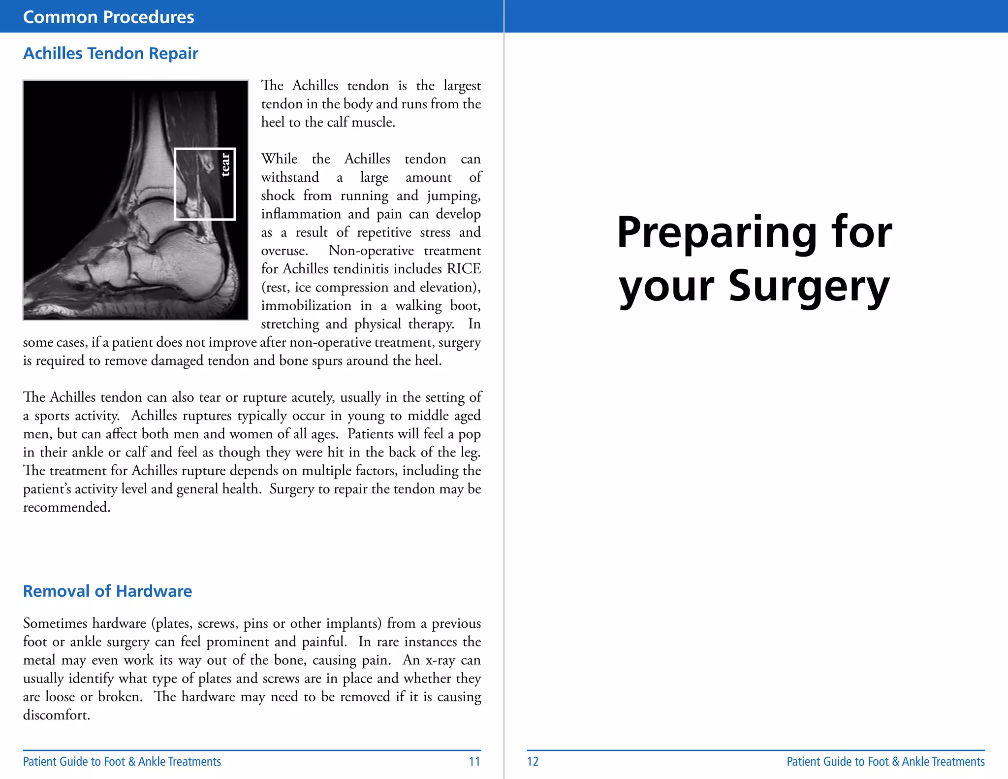Footguide 09162013-noninteractive | PDF