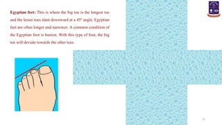 Human Foot Measurement-Foot Measurement.pptx